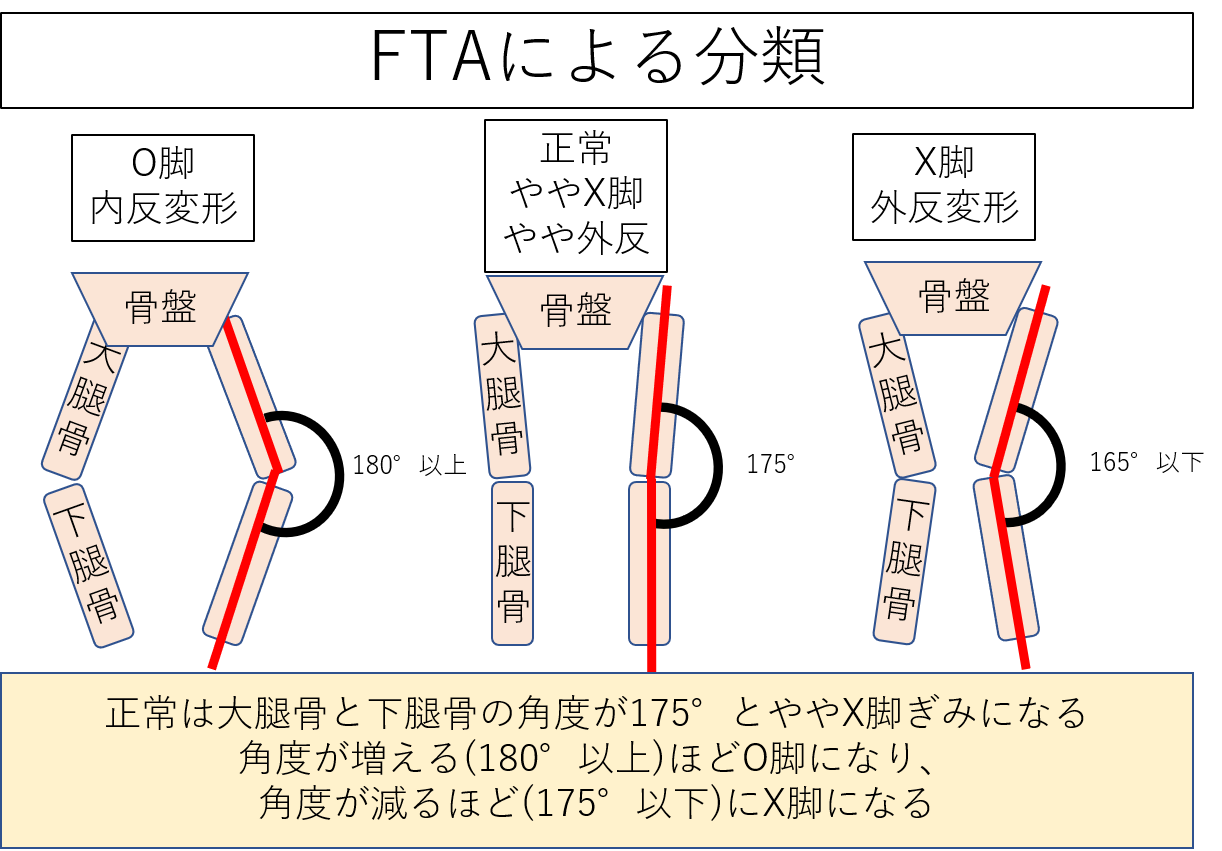 O脚やX脚を判断するための基準とは？ ～FTAやミクリッツ線を理解しよう～ | 理学療法士が作る「膝関節」の勉強部屋