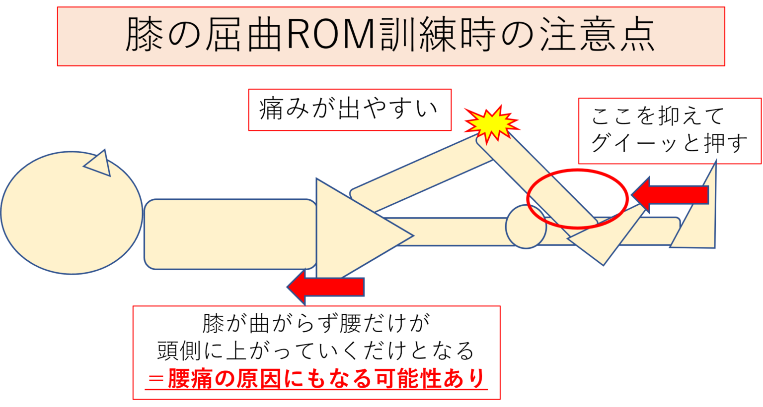 TKA術後の膝屈曲ROMの改善に対するアプローチについて～ROM訓練編～ | 理学療法士が作る「膝関節」の勉強部屋
