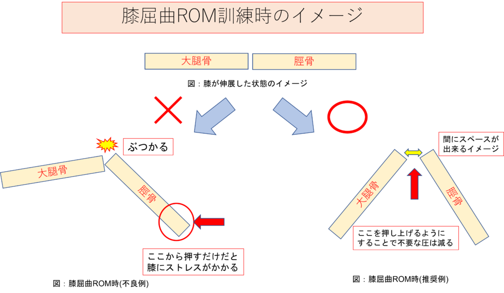 TKA術後の膝屈曲ROMの改善に対するアプローチについて～ROM訓練編～ | 理学療法士が作る「膝関節」の勉強部屋